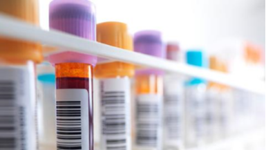 Change to Anti-dsDNA antibody testing requirements – Awanui Labs ...