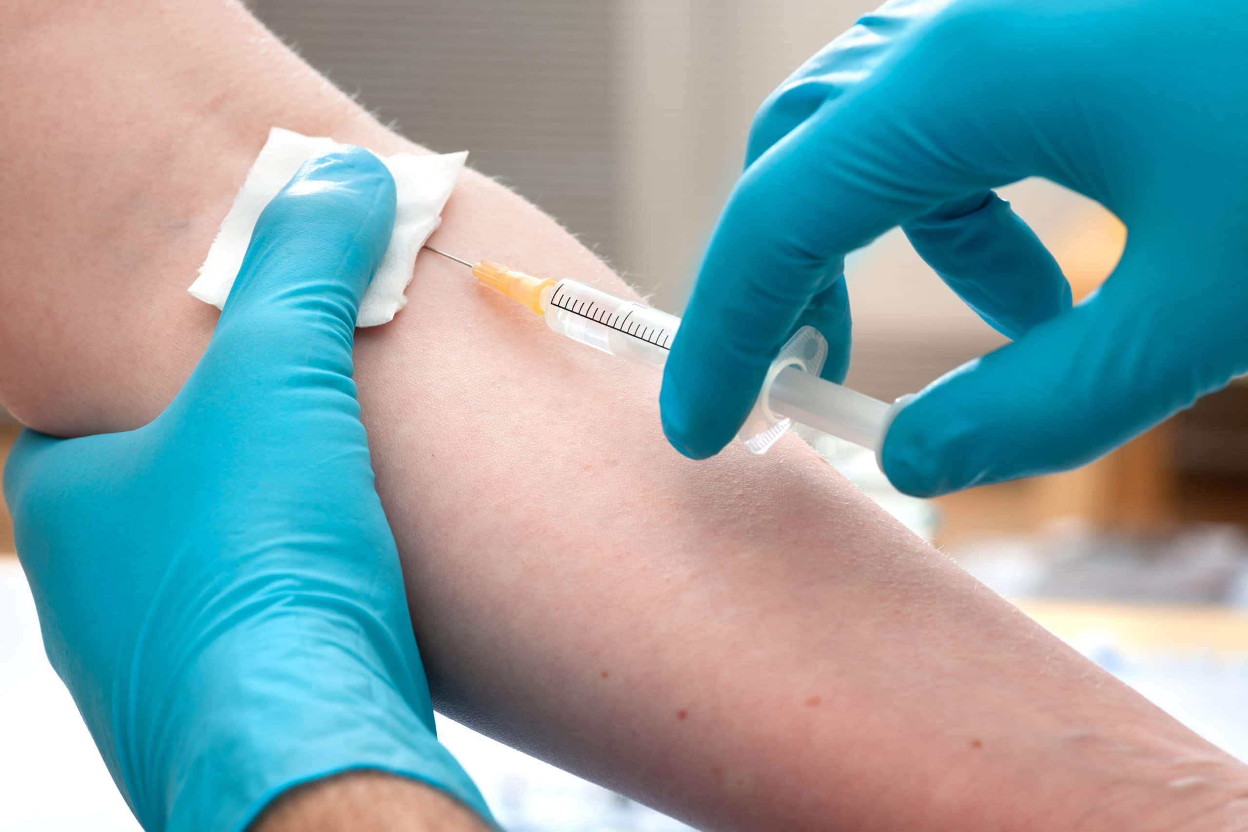 Mantoux Testing Service Resumed Labtests mantoux-testing-service-resumed-labtests