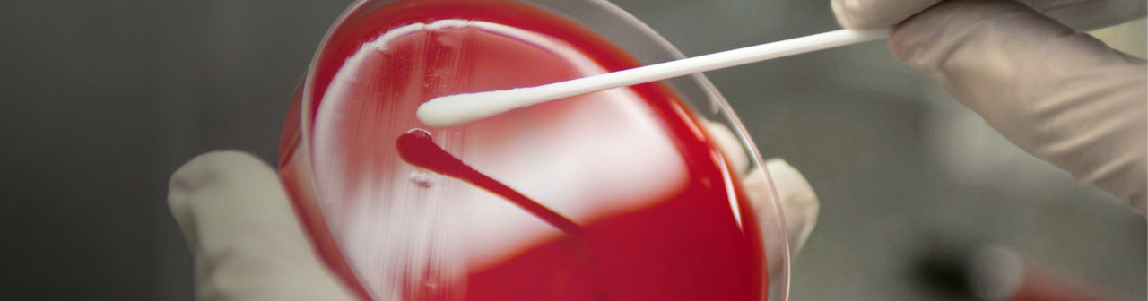 Changes to processing of female genital swabs – Awanui Labs - Hawke's Bay